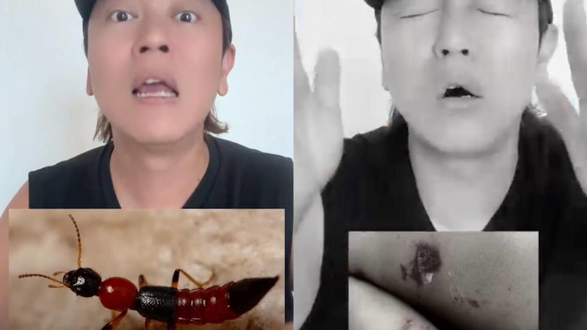 Sleeping Naked Left Jaspers Lai With Painful Blisters After Charlie Ant ...